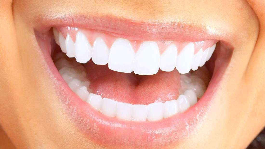 Cosmetic Dentists Brisbane | Ultimate Guide to Smile Makeovers